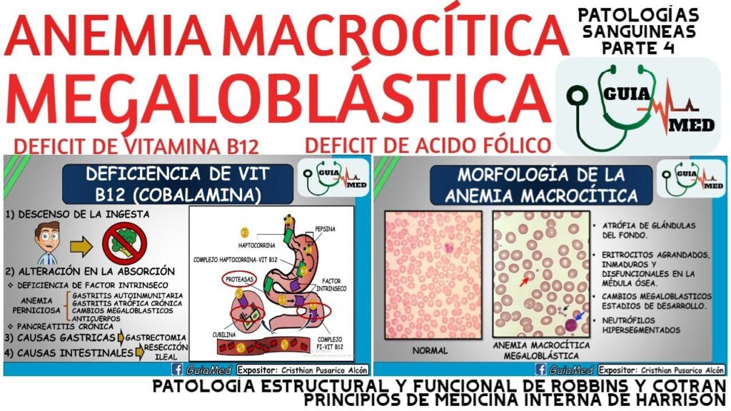¿Anemia por deficiencia de folato? ¡Descubre cómo vencerla con estilo y ...