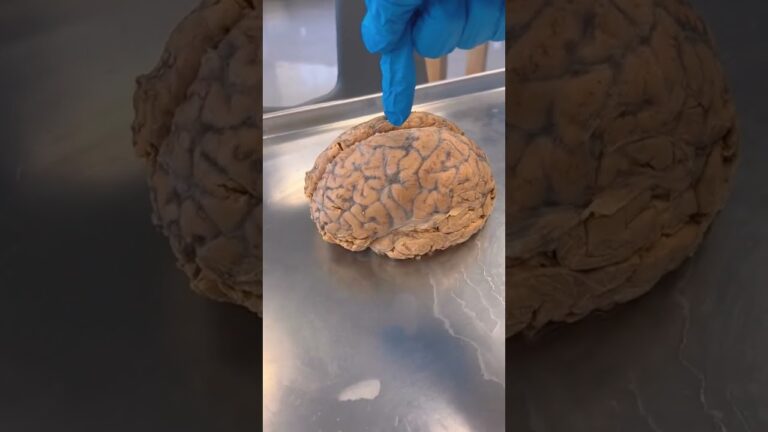 Descubre el cerebro humano real: ¡Tu mente es más fascinante de lo que ...