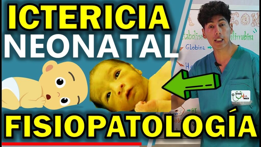 Ictericia neonatal: ¿por qué tu bebé luce como un pequeño sol? - Noticias en España - Vaima